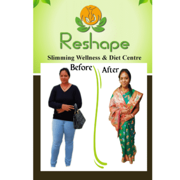 Diet Results With Ahmedabad's Best Dietician